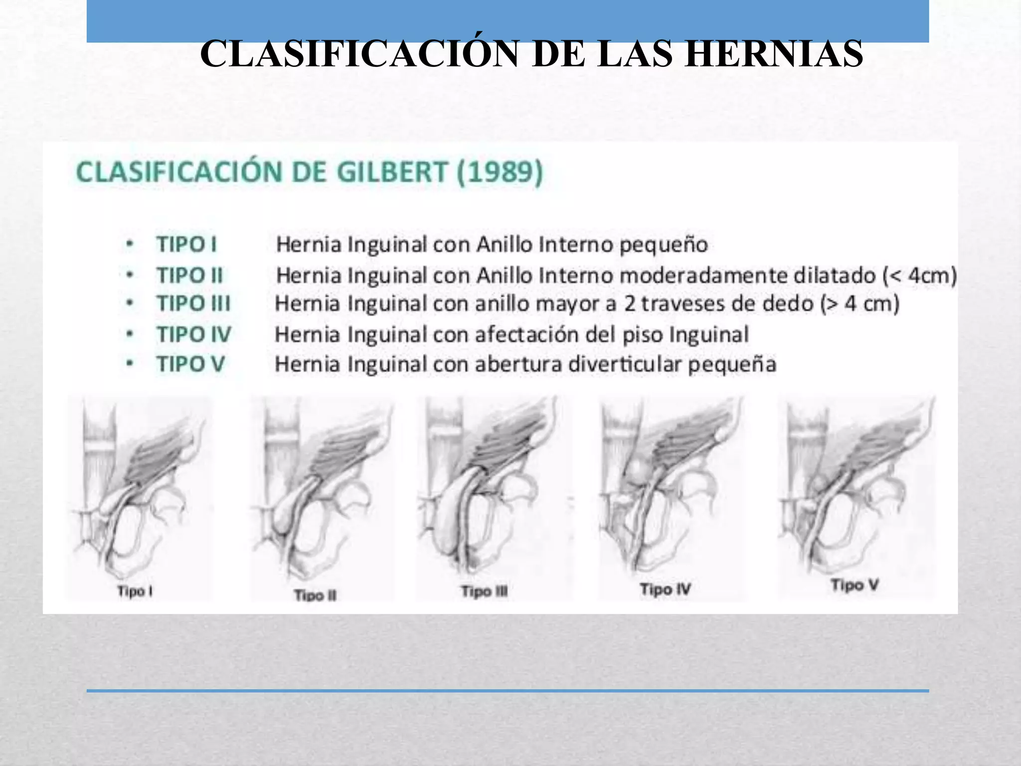 ANATOMIA DE LA REGION INGUINAL .ppt