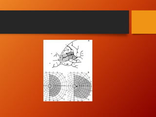 Anatomia de la via visual | PPTX