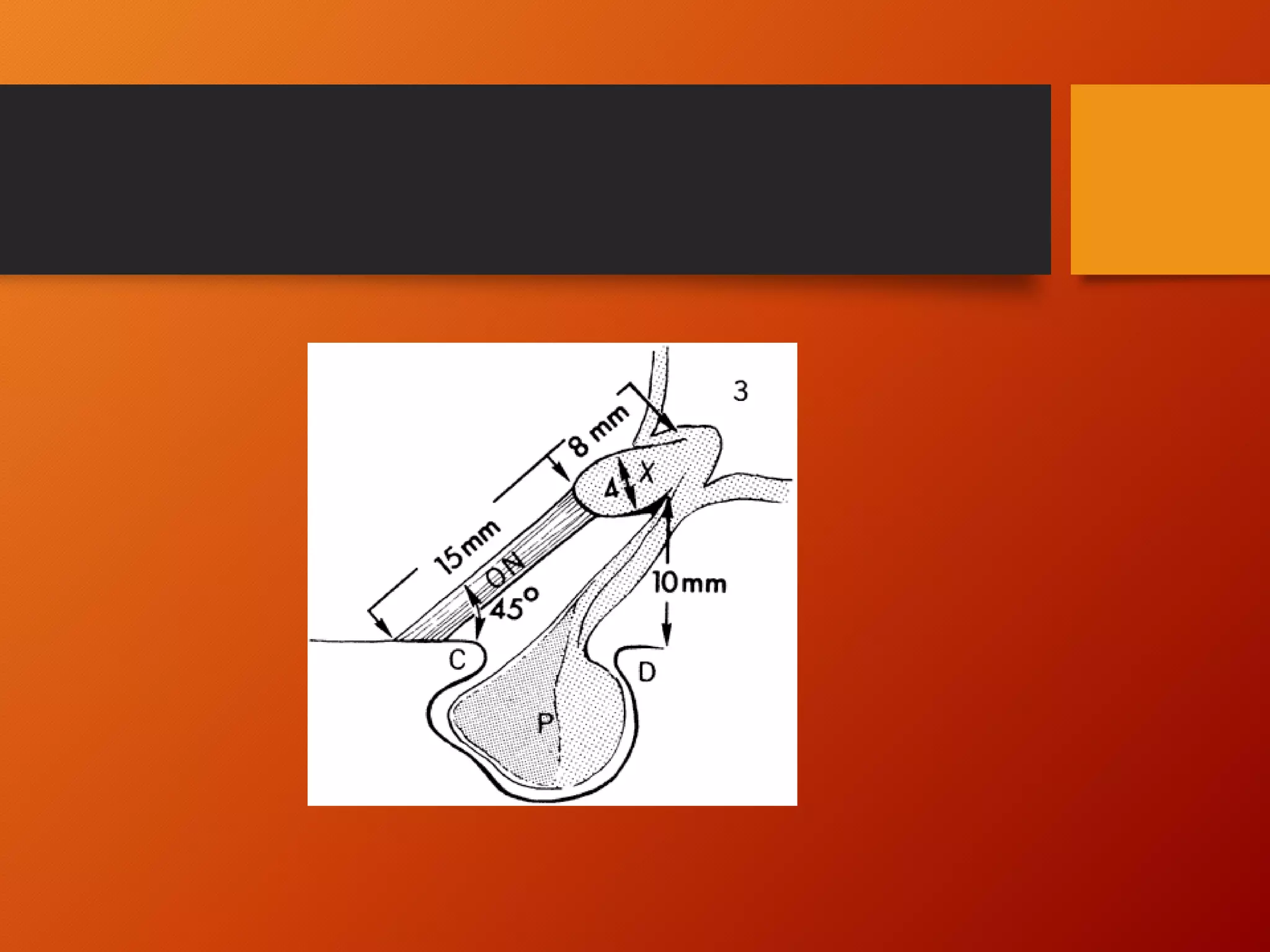Anatomia de la via visual | PPTX