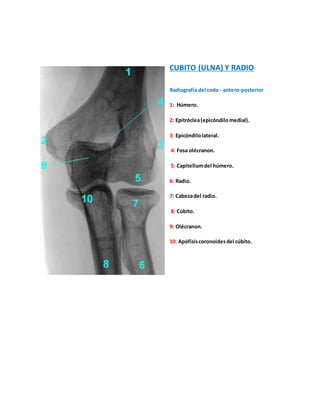 Anatomía Radiológica del Brazo 6ª Parte