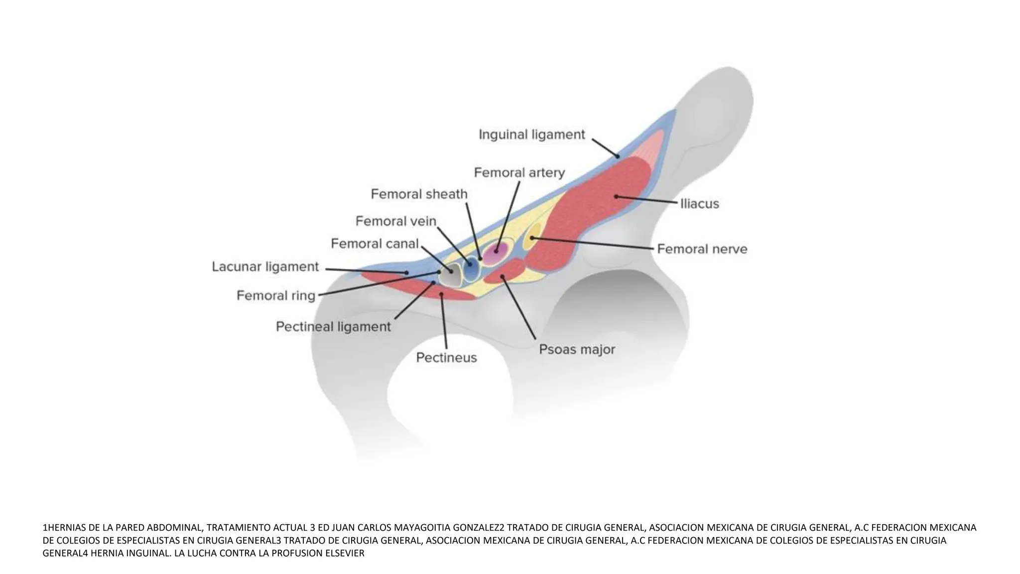 Anatomía del canal inguinal, hernias inguinales y [Autoguardado].pptx