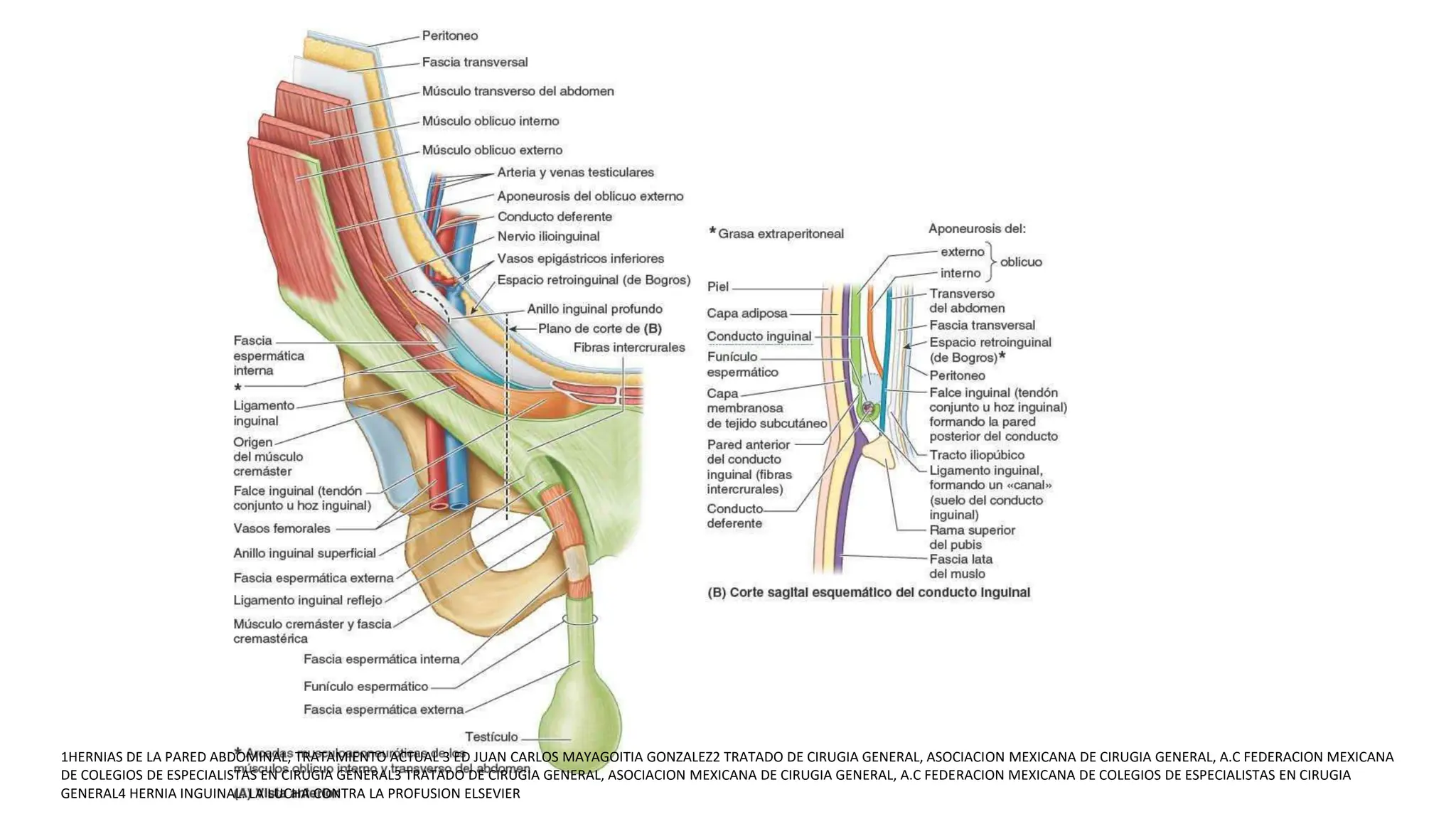 Anatomía del canal inguinal, hernias inguinales y [Autoguardado].pptx
