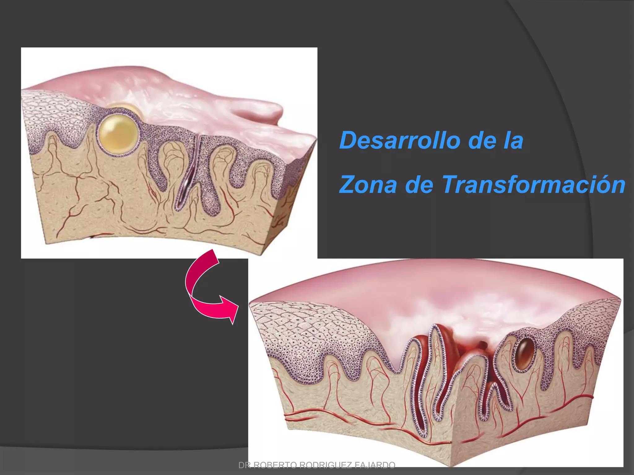 Anatomía del cervix | PDF