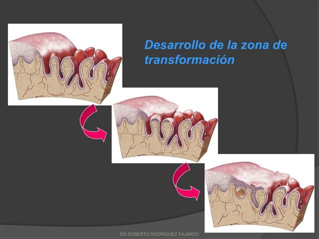 Anatomía del cervix | PDF