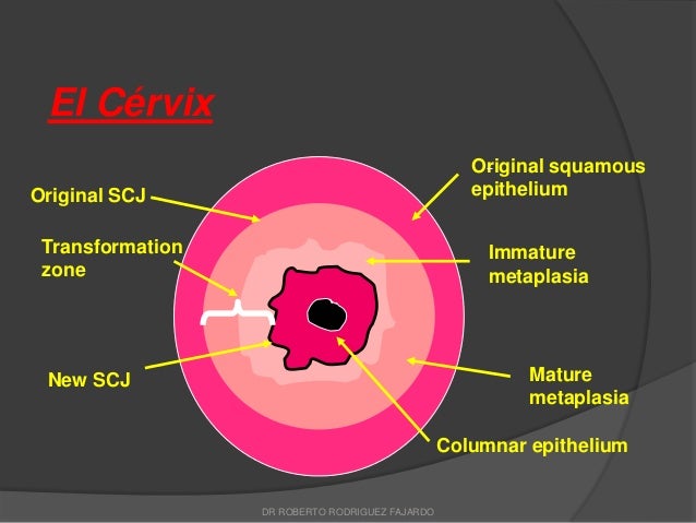 Anatomía del cervix