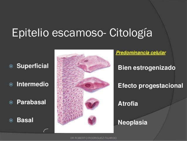 Anatomía del cervix