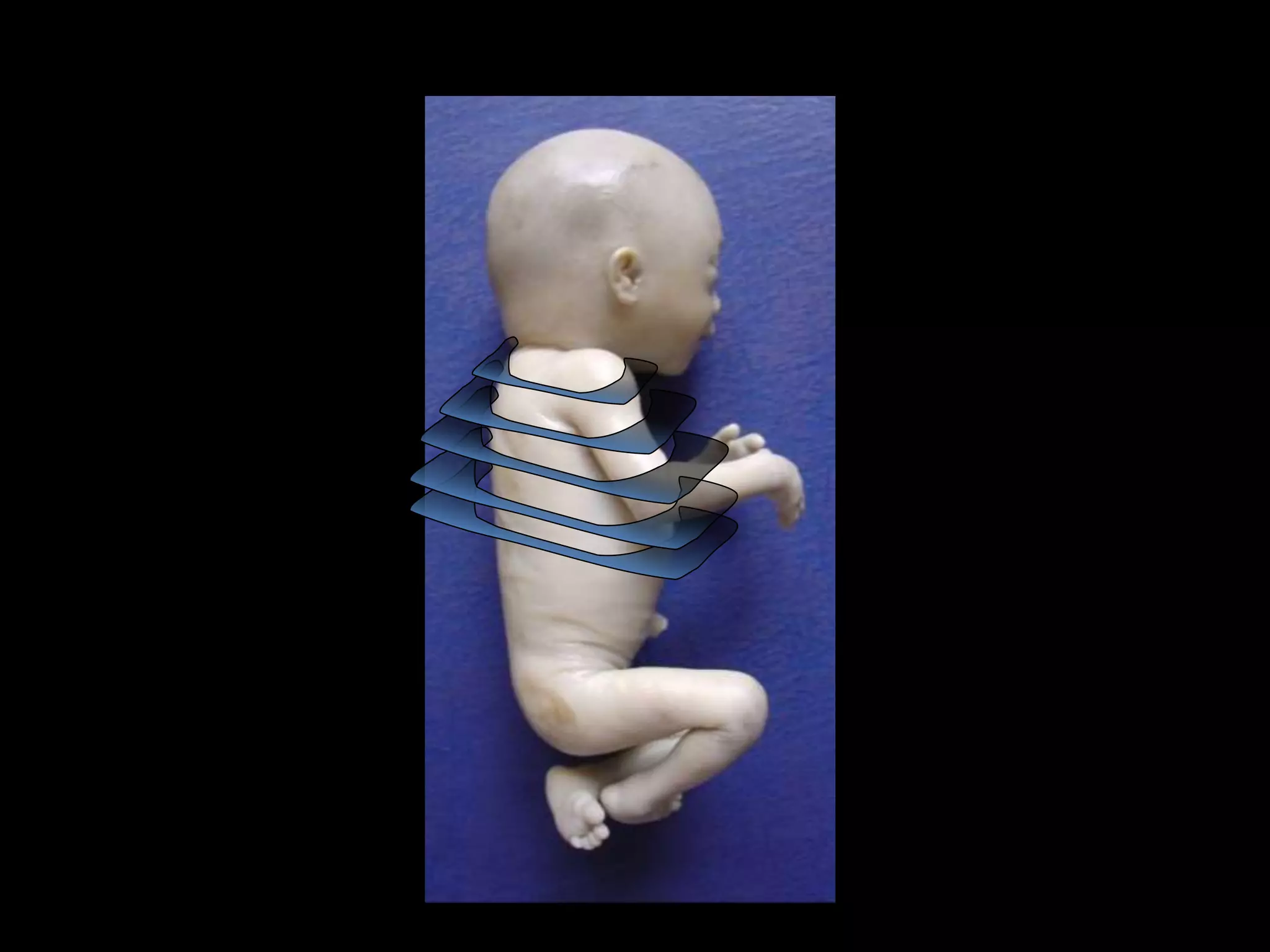 Anatomia del corazon fetal | PPTX