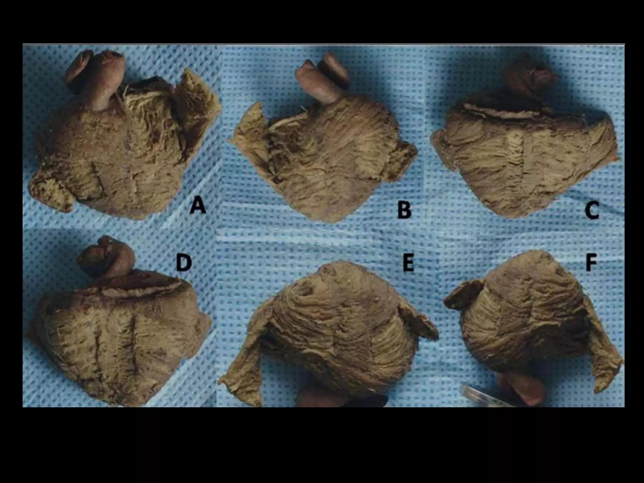 Anatomia del corazon fetal | PPTX
