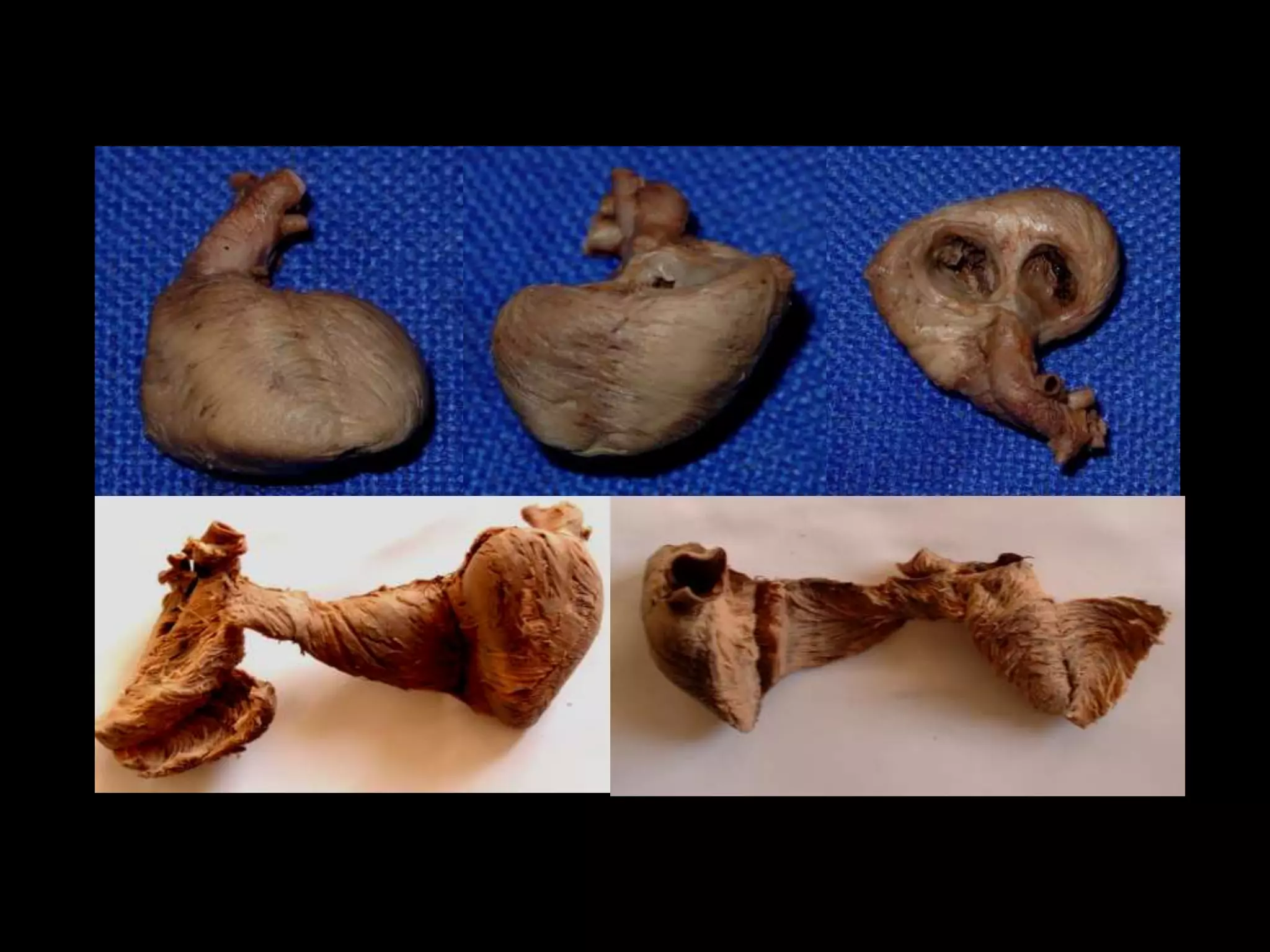 Anatomia del corazon fetal | PPTX