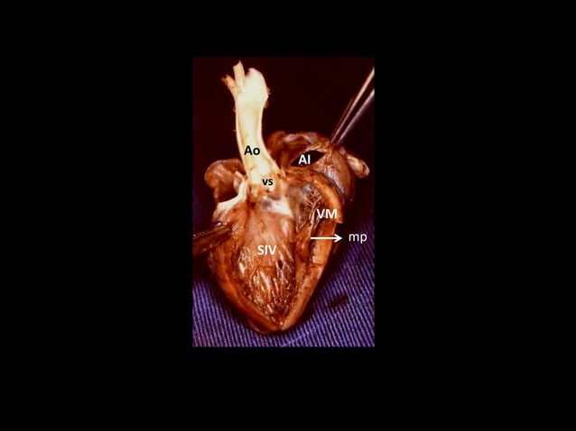 Anatomia del corazon fetal | PPTX