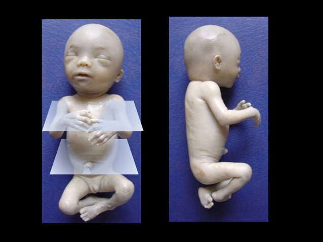 Anatomia del corazon fetal | PPTX