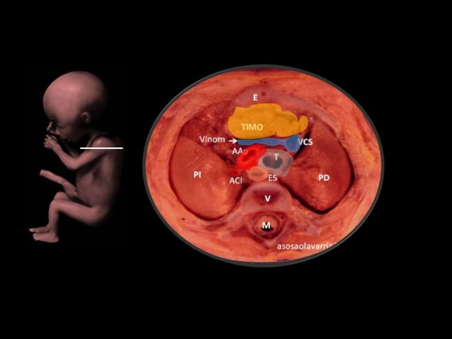 Anatomia del corazon fetal | PPTX