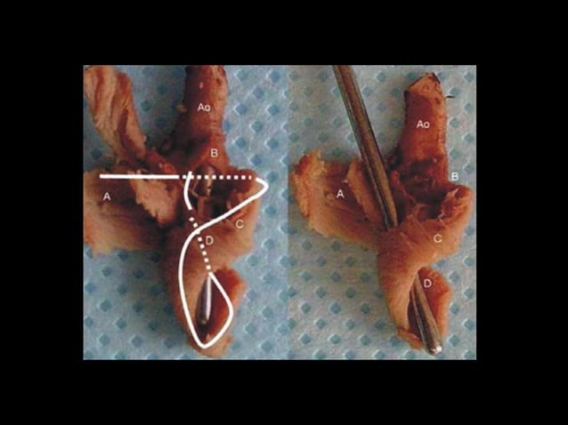 Anatomia del corazon fetal | PPTX