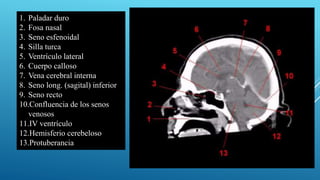 Anatomia del craneo por imagen | PPTX