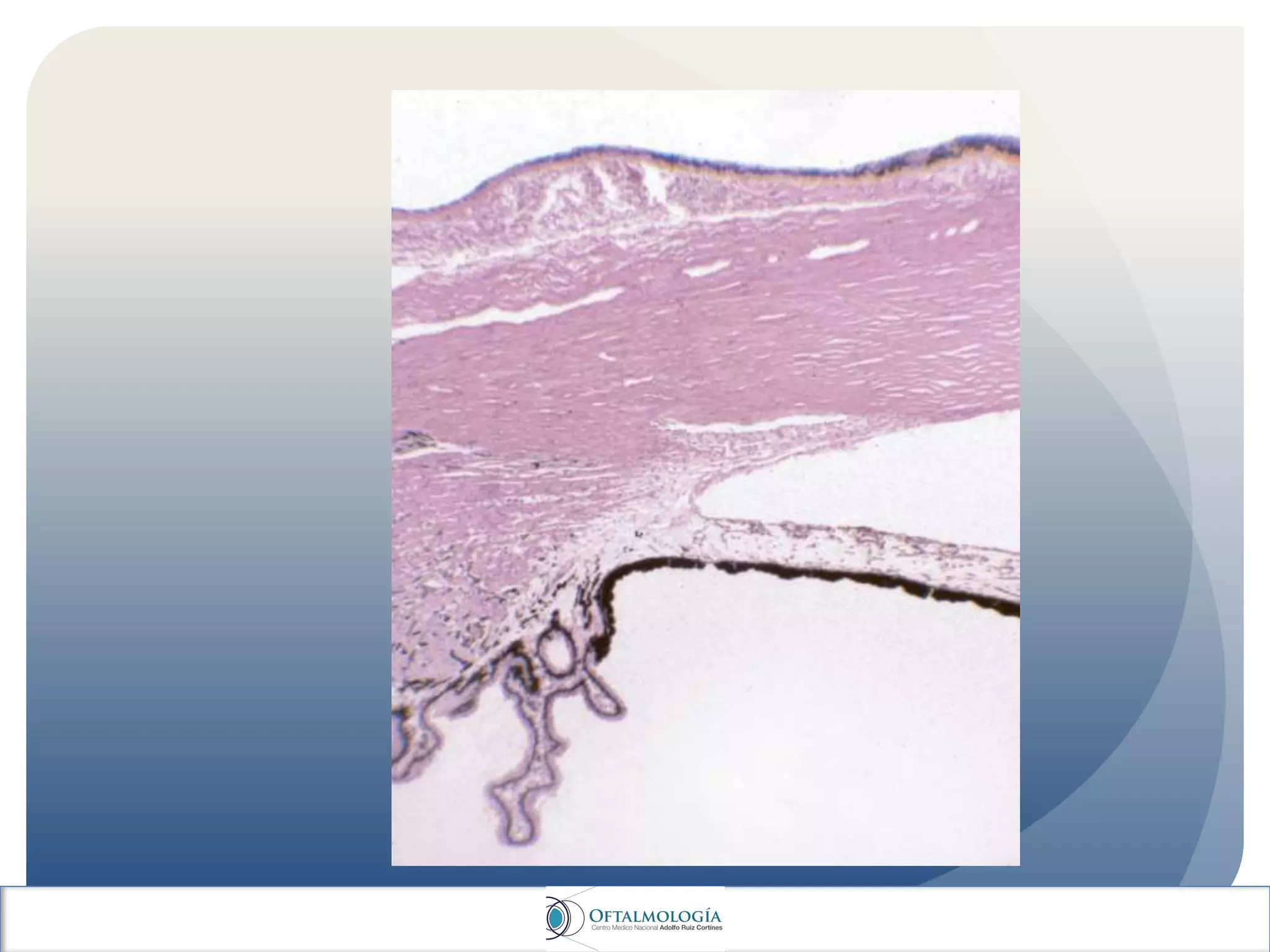 Anatomia del iris, cuerpo ciliar y pars plana y plicata | PPTX