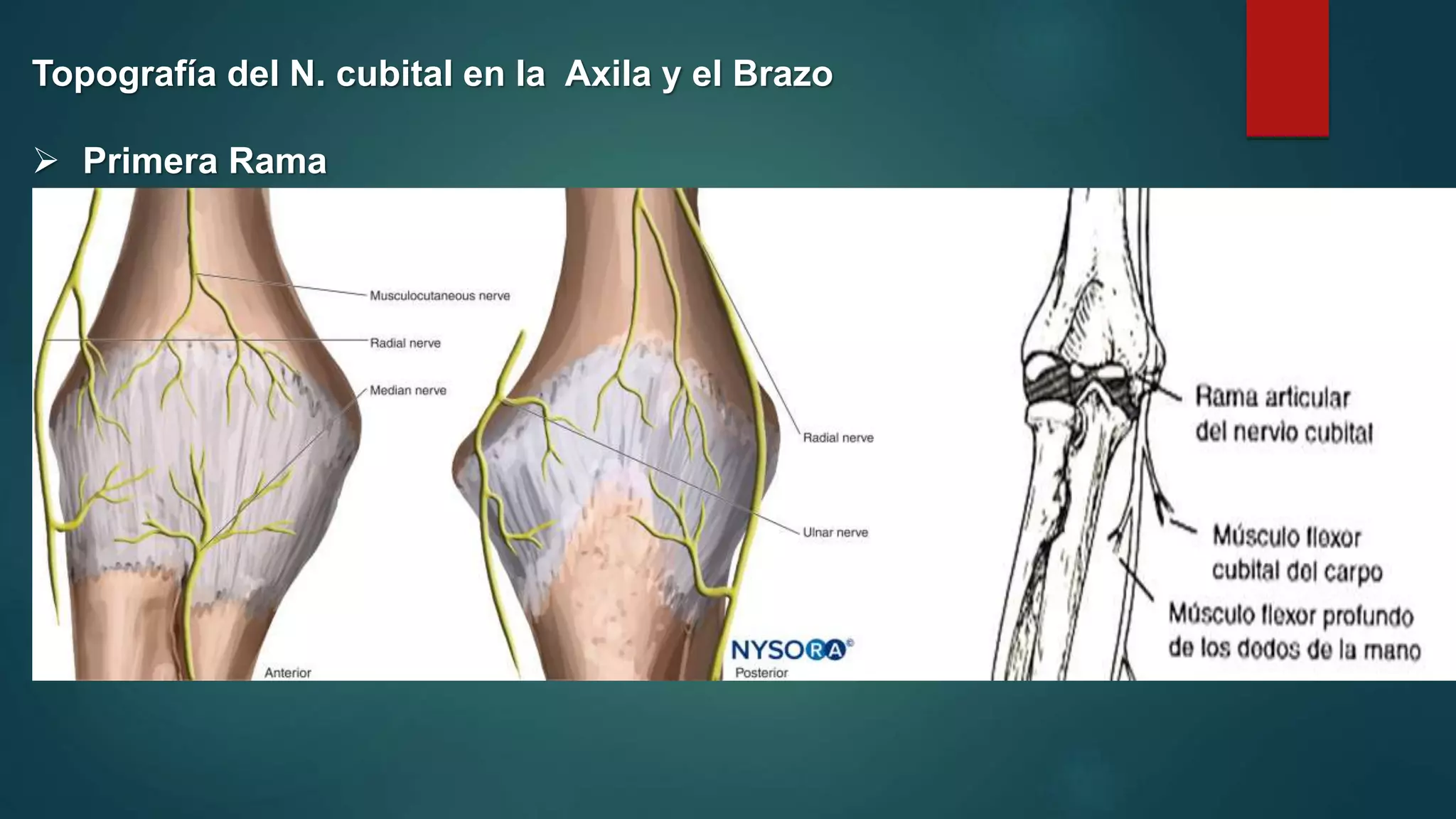 Anatomía Del Nervio Cubital Ppt MANEJO CONSERVADOR NEUROPATIA