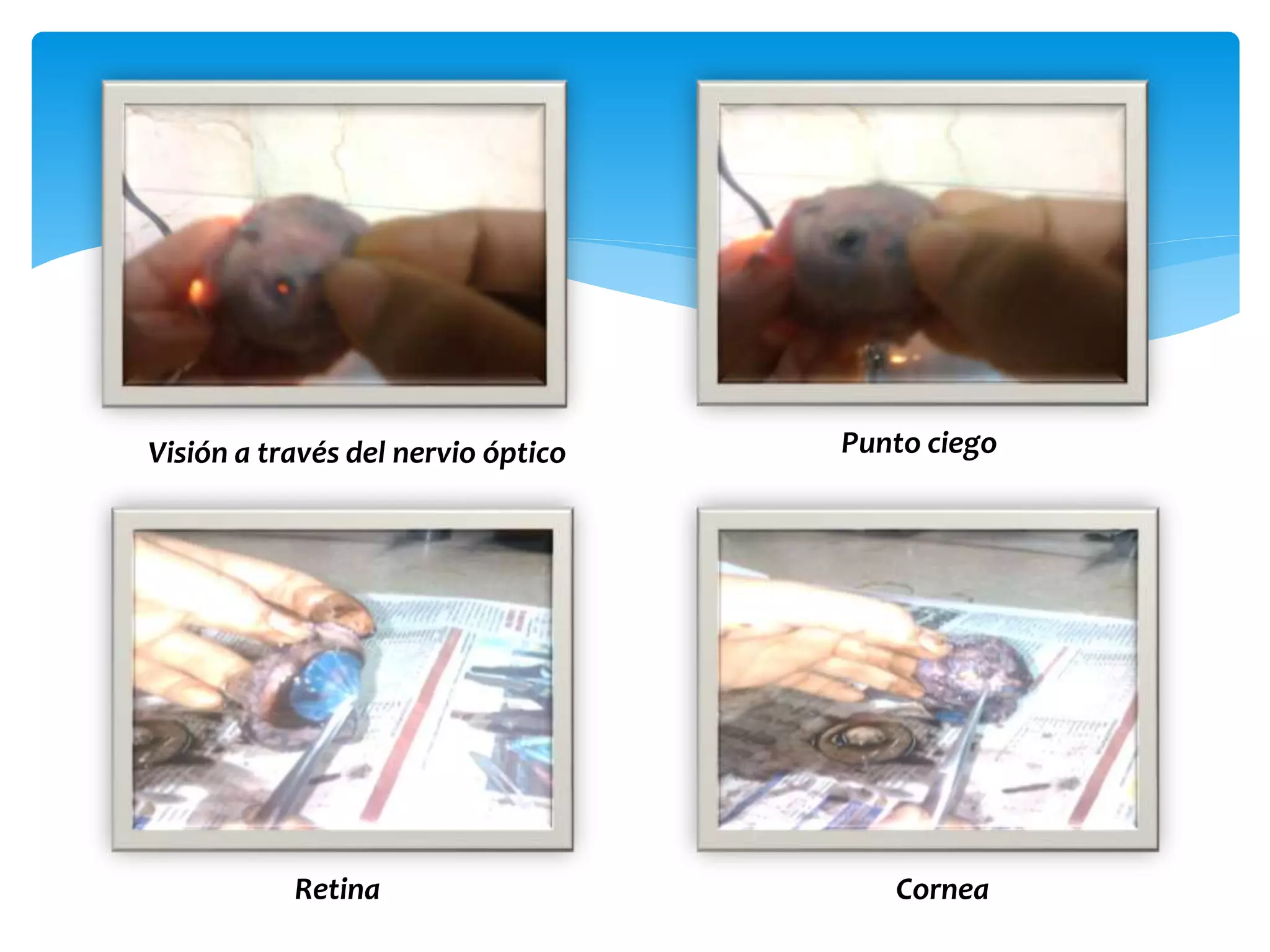 Anatomia del ojo, optica de la vision | PPT