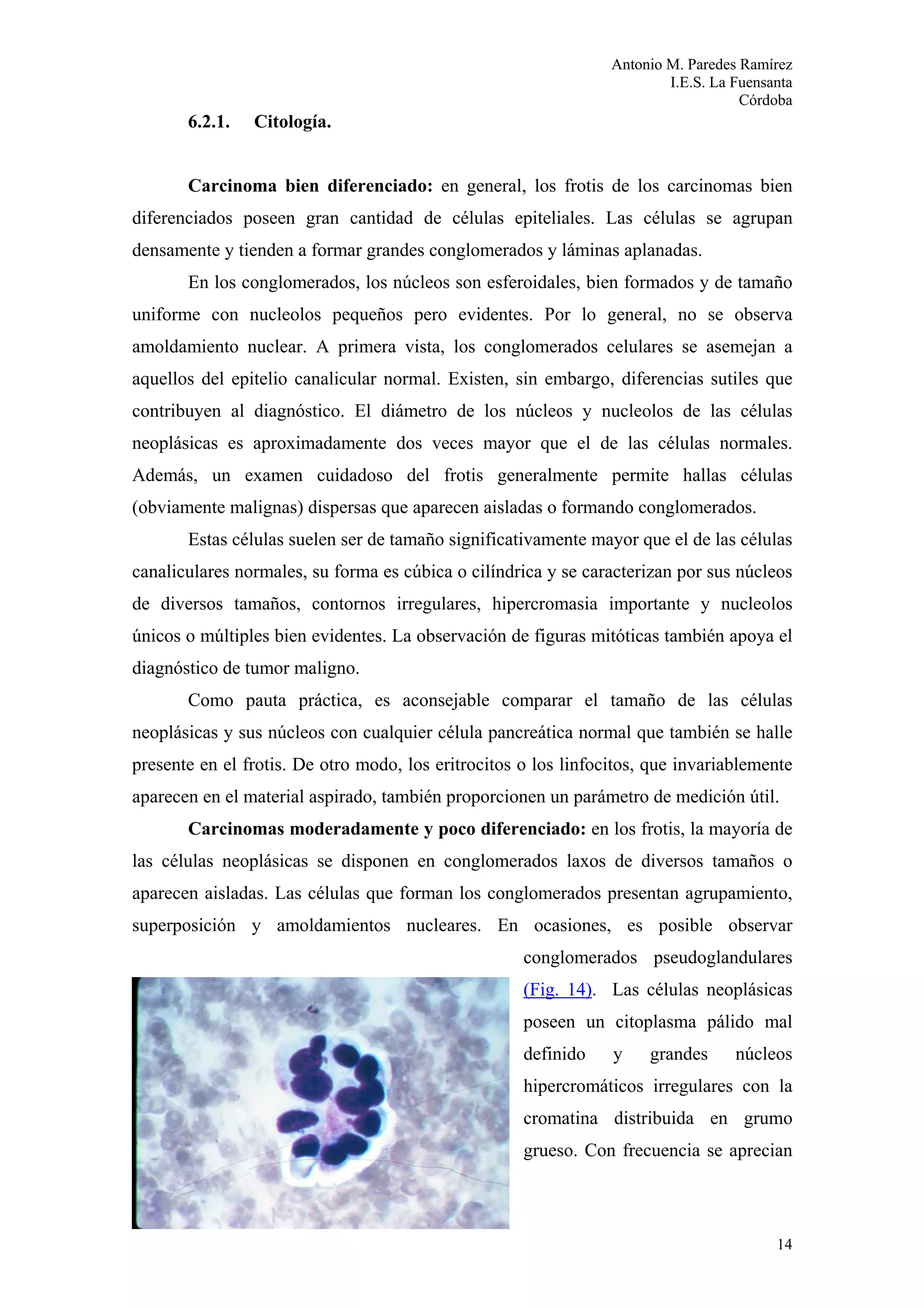 Anatomia del pancreas | PDF