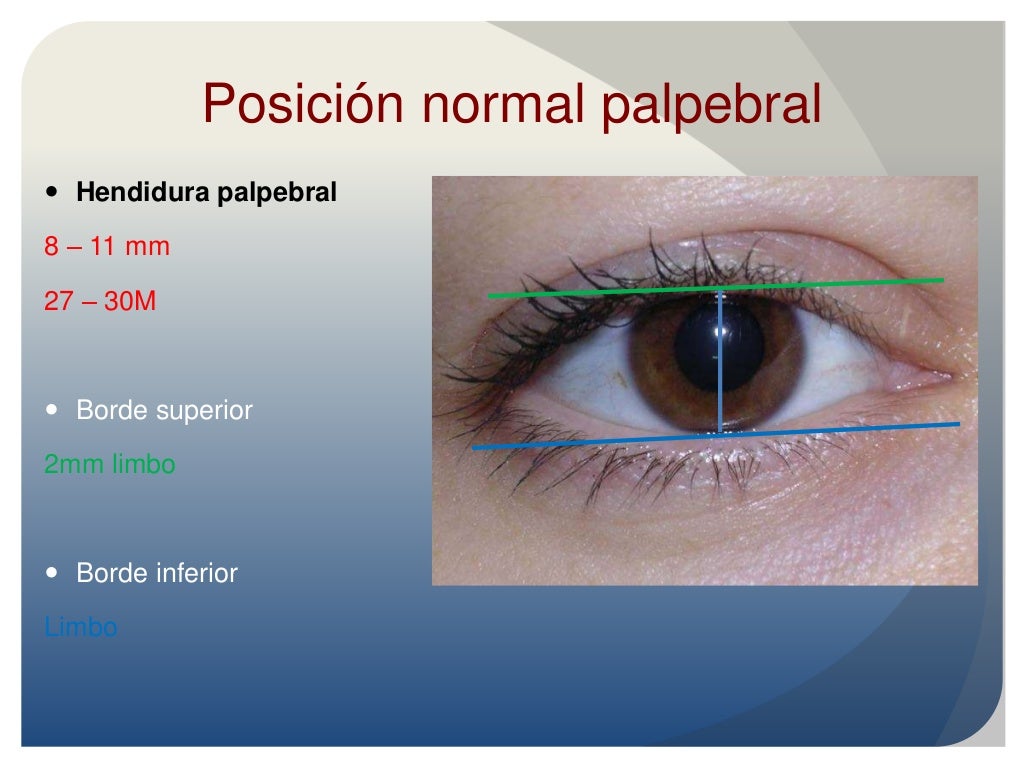 Anatomia del parpado