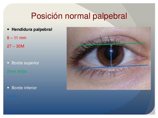 Anatomia del parpado