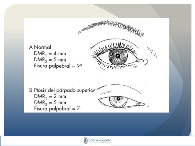 Anatomia del parpado