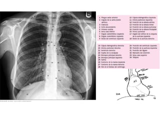 Anatomía y proyecciones radiológicas del torax | PDF