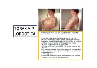 Anatomía y proyecciones radiológicas del torax | PDF