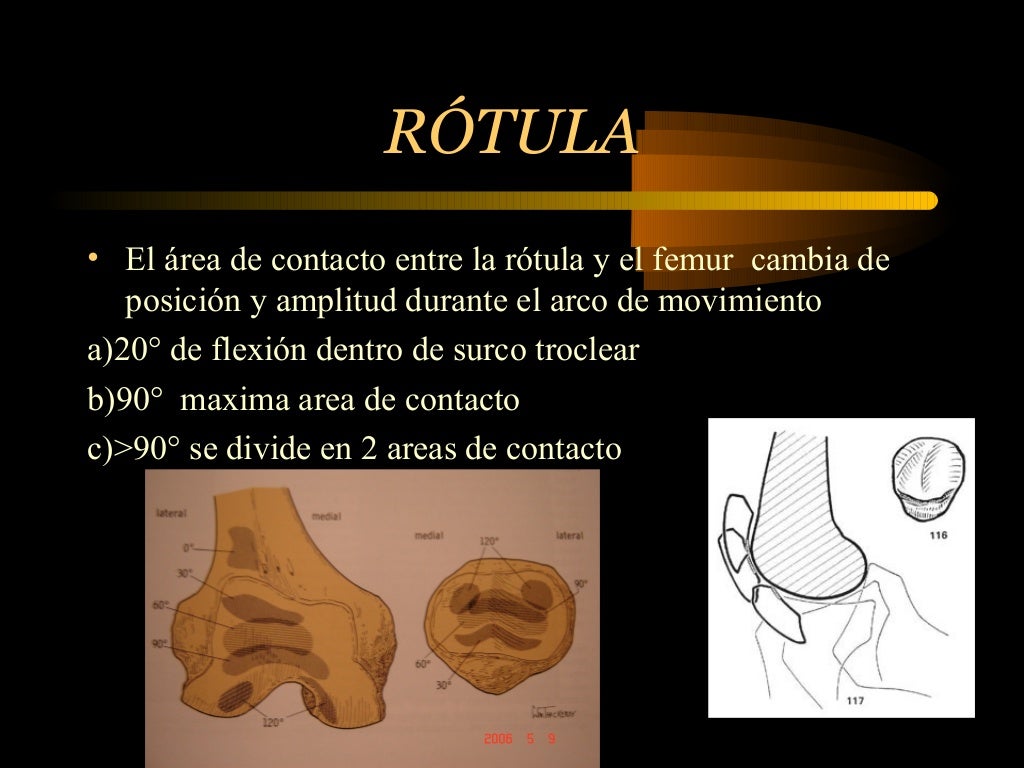 Hiperpressão Do Mecanismo Extensor - RETOEDU