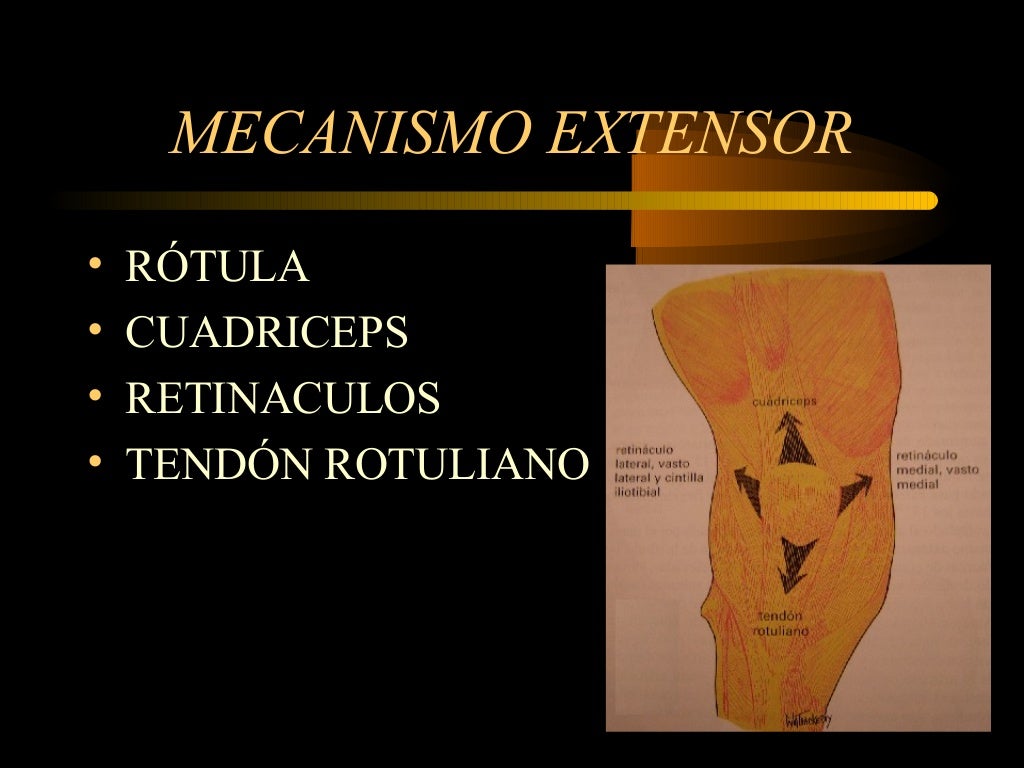 Hipersolicitação Do Mecanismo Extensor - RETOEDU