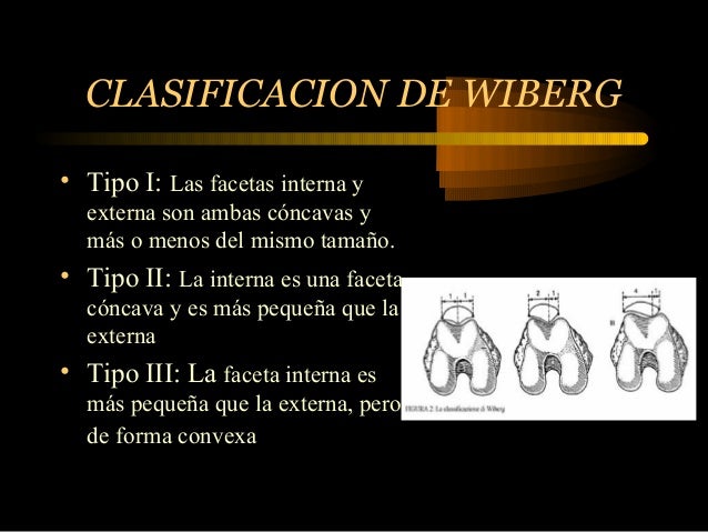 Anatomia de mecanismo extensor de la rodilla