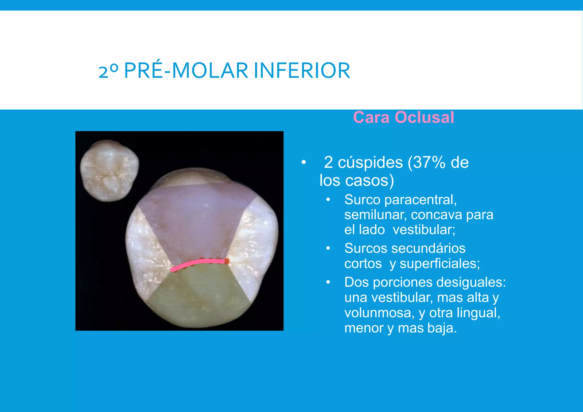 Anatomia dental. 2 Premolar Sup y Inf | PPTX