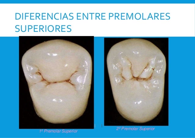 Anatomia dental. 2 Premolar Sup y Inf