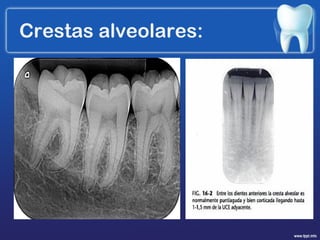 Hueso Alveolar | PPT