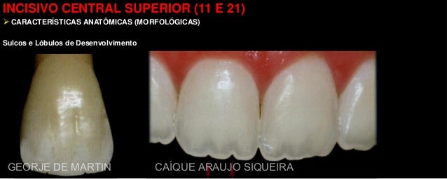 Anatomia dental protec incisivos superiores - georje de martin 2013