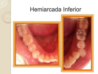 Anatomia dentaria | PPTX