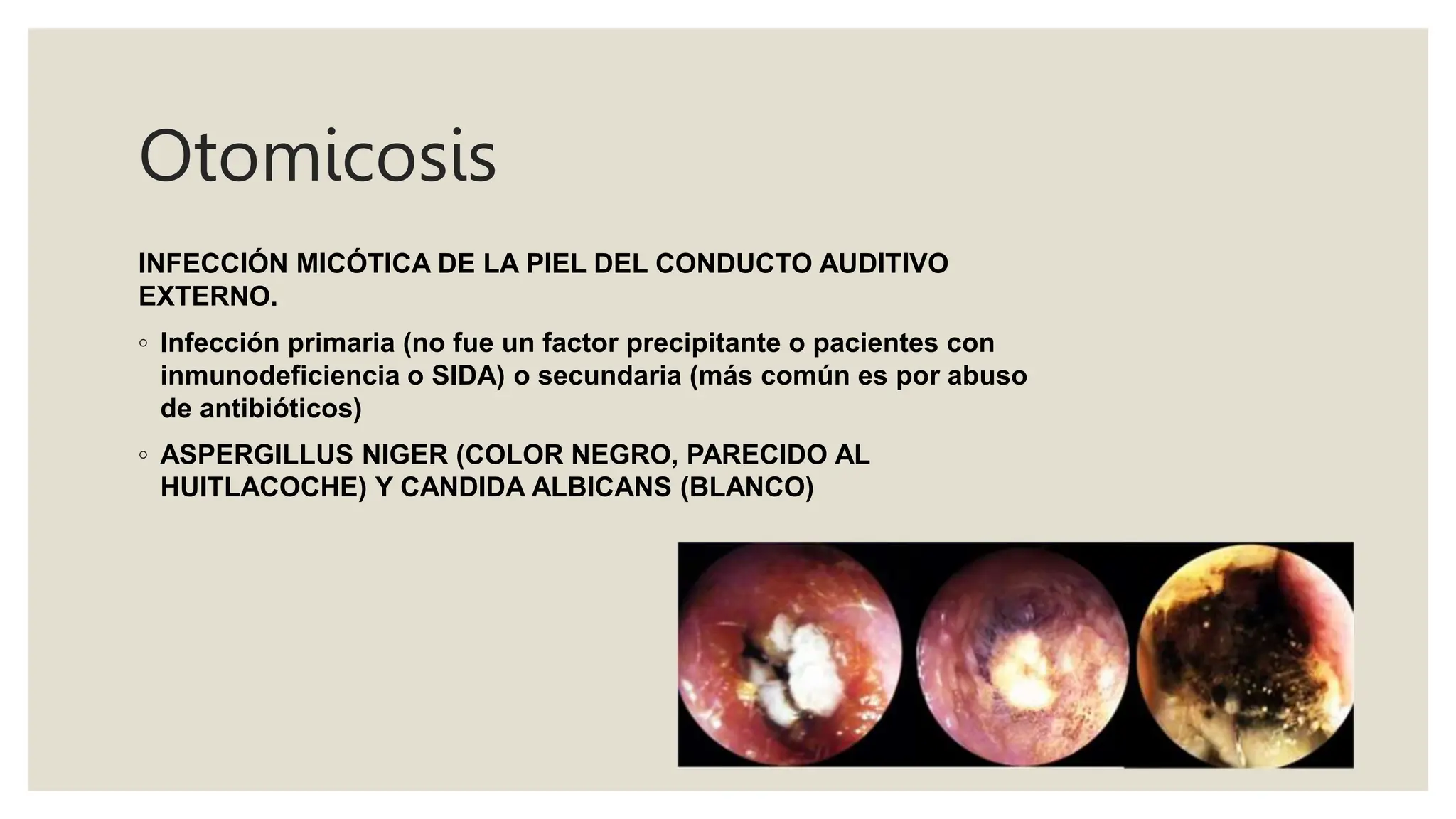 ANATOMIA DE OIDO Y OTITIS AGUDA GPC.pptx