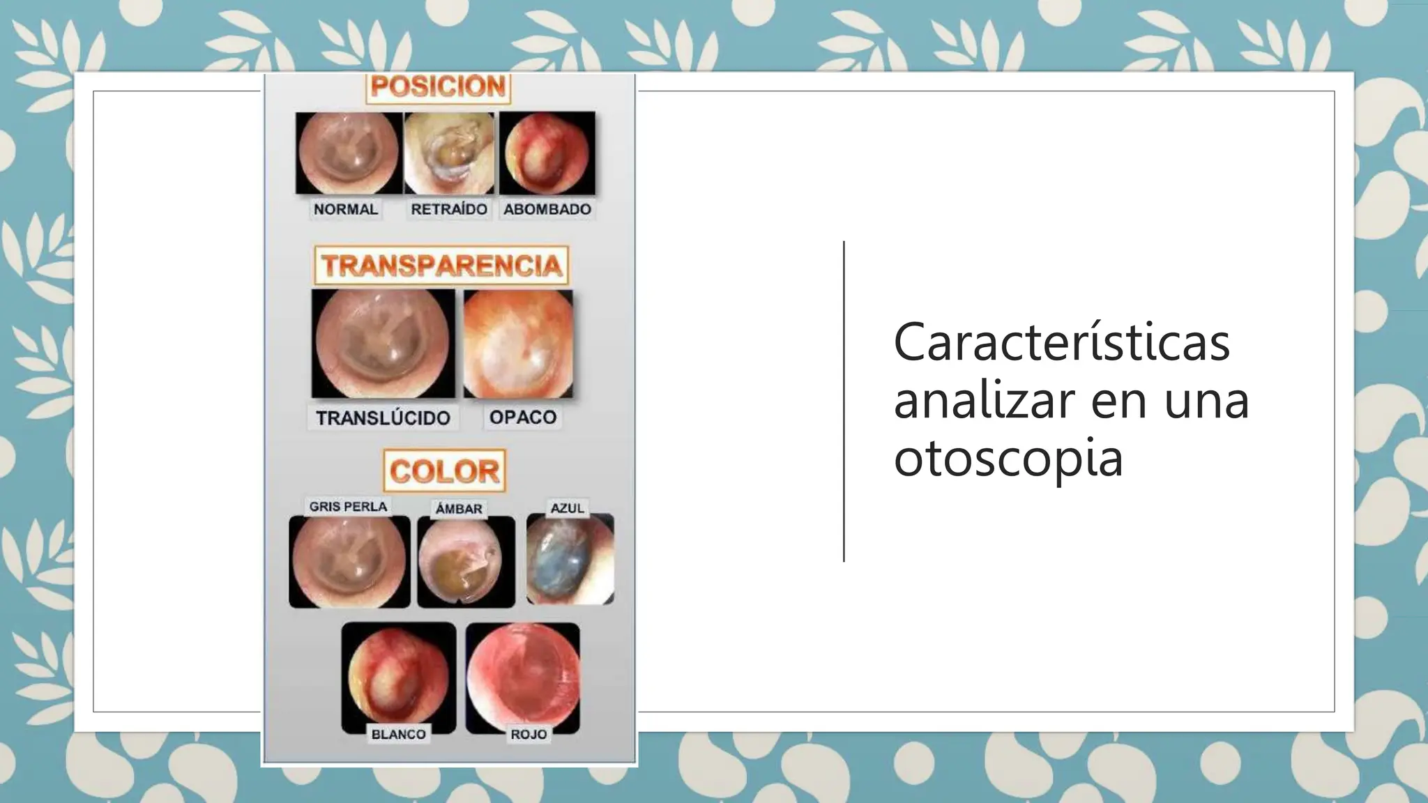 ANATOMIA DE OIDO Y OTITIS AGUDA GPC.pptx