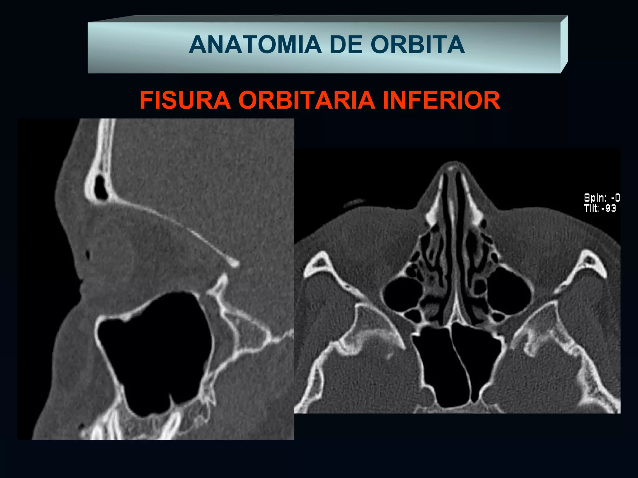 Anatomía de Orbita | PPT
