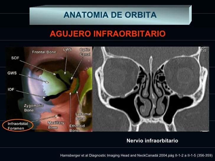 Anatomía de Orbita