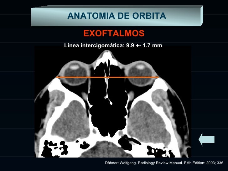 Anatomía de Orbita