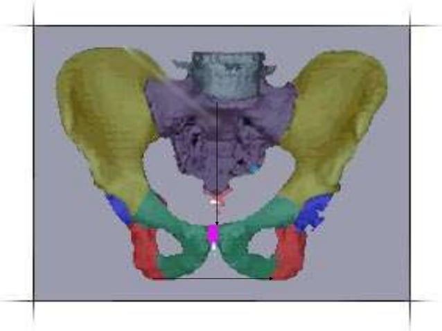 Anatomia de pelvis pelvimetria | PPT