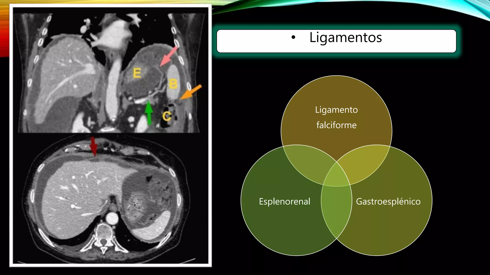 Anatomia de peritoneo | PPT