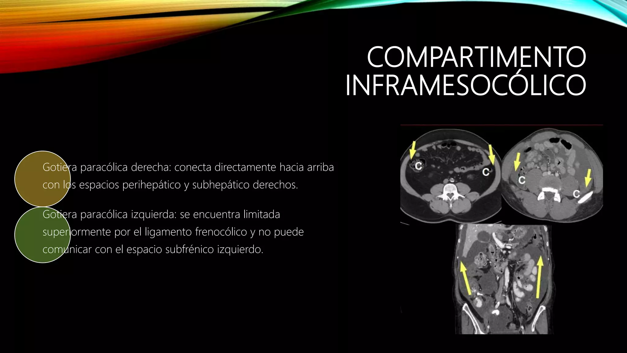 Anatomia de peritoneo | PPTX