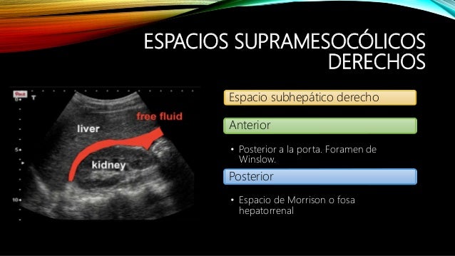 Anatomia de peritoneo