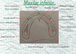 Anatomía de rebordes.pdf