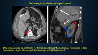 ANATOMIA DE RETROPERITONEO GASTROENTEROLOGIA | PPTX