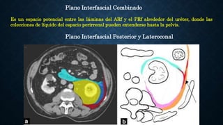 ANATOMIA DE RETROPERITONEO GASTROENTEROLOGIA | PPTX