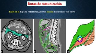 ANATOMIA DE RETROPERITONEO GASTROENTEROLOGIA | PPTX