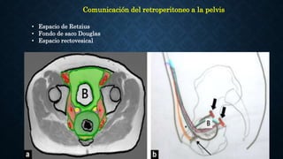 ANATOMIA DE RETROPERITONEO GASTROENTEROLOGIA | PPTX