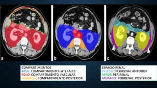 ANATOMIA DE RETROPERITONEO GASTROENTEROLOGIA | PPTX